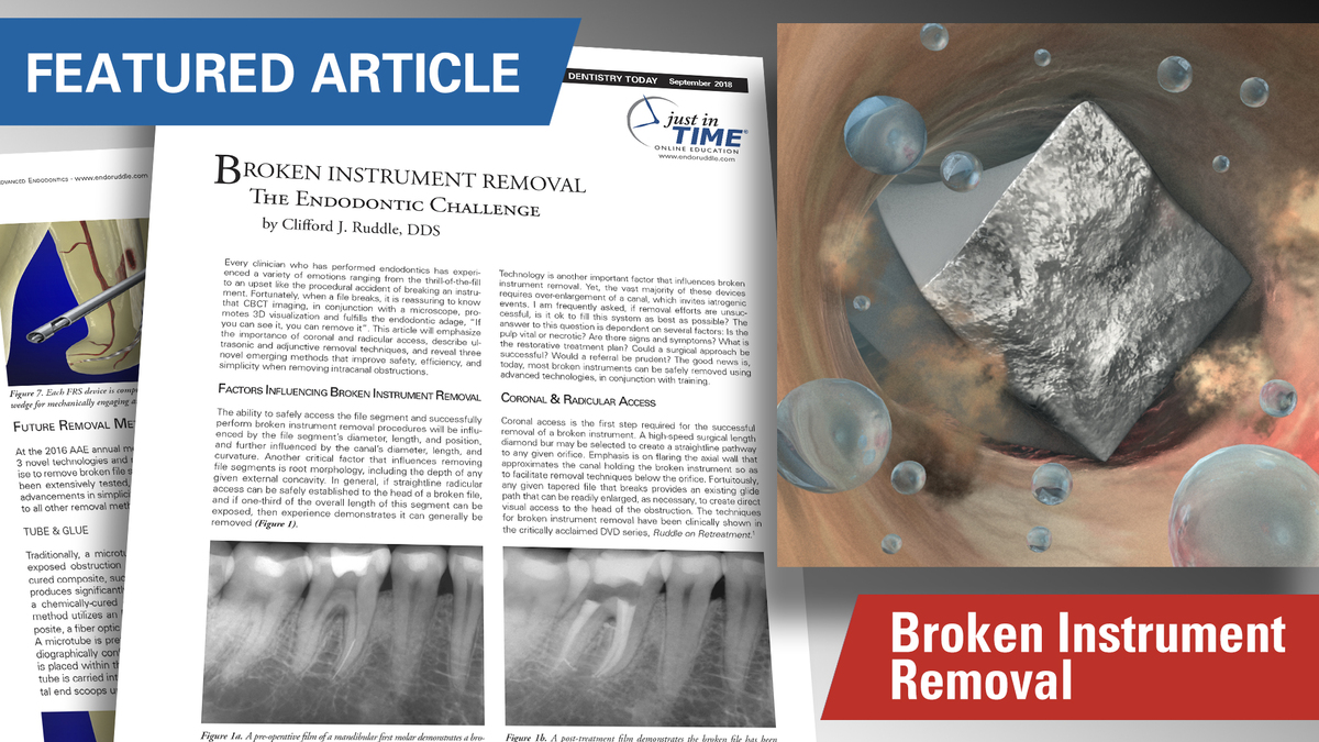 Advanced Endodontics | Advanced Endodontics