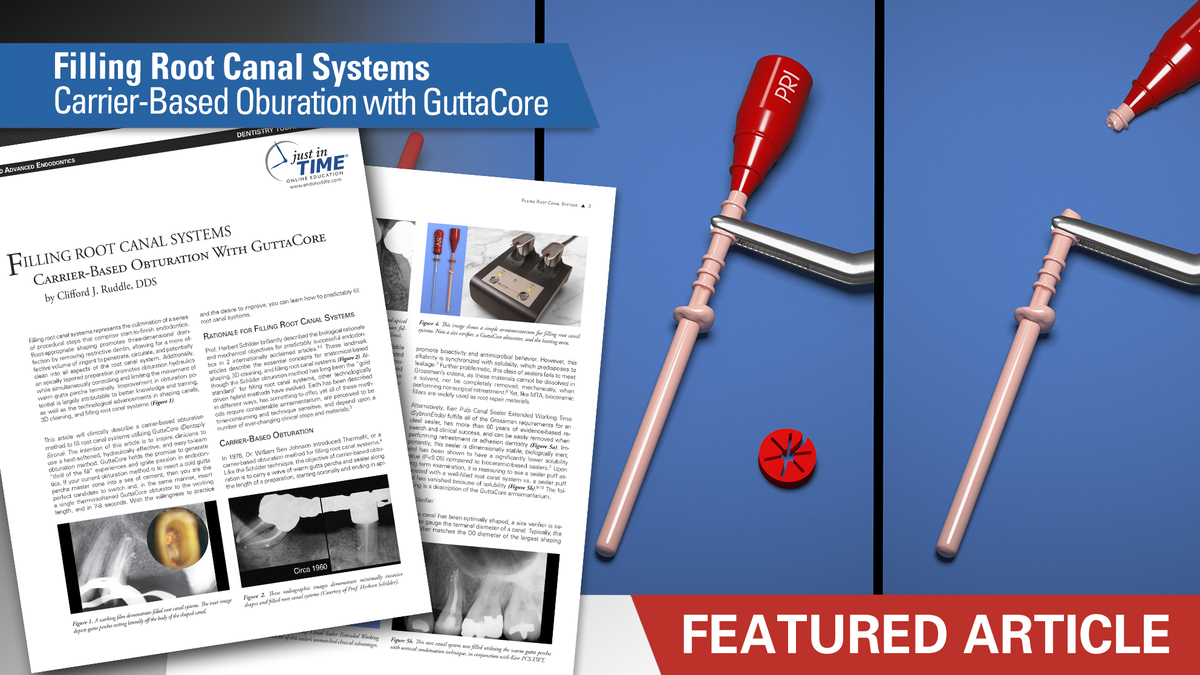 Advanced Endodontics | Advanced Endodontics