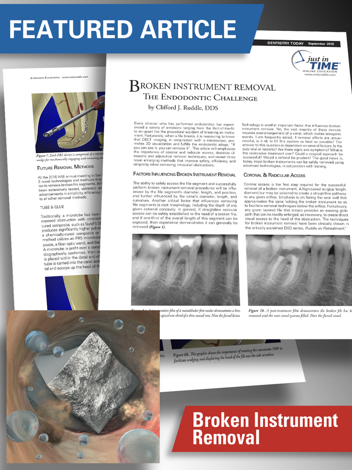 Advanced Endodontics | Advanced Endodontics