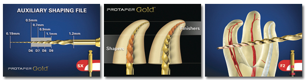Invention: ProTaper System Rotary File Series | Advanced Endodontics