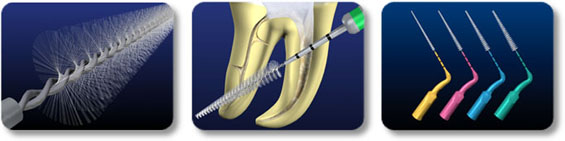Invention: Endodontic MicroBrush | Advanced Endodontics