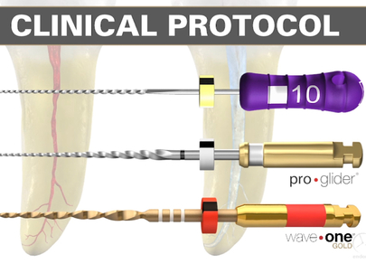 WaveOne Gold - Single-File Shaping Technique